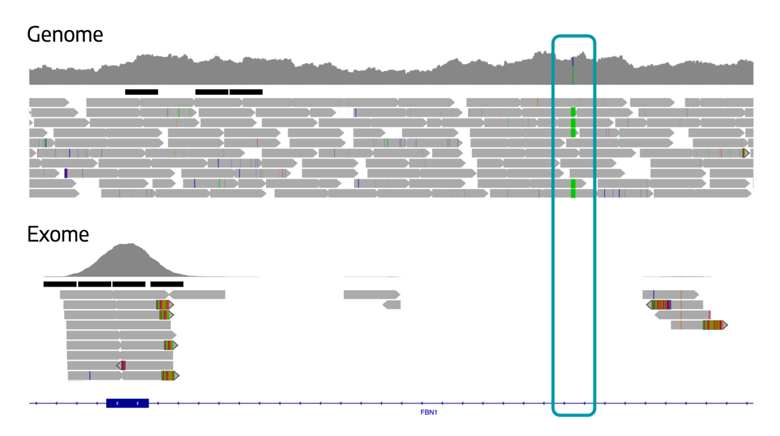 Case Study: FBN1 Intronic Variant Provides Marfan Syndrome Diagnosis ...